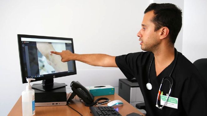 OMS cambia el nombre de viruela del mono a Mpox