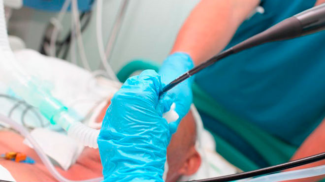 Broncoscopia en el Hospital de los Valles