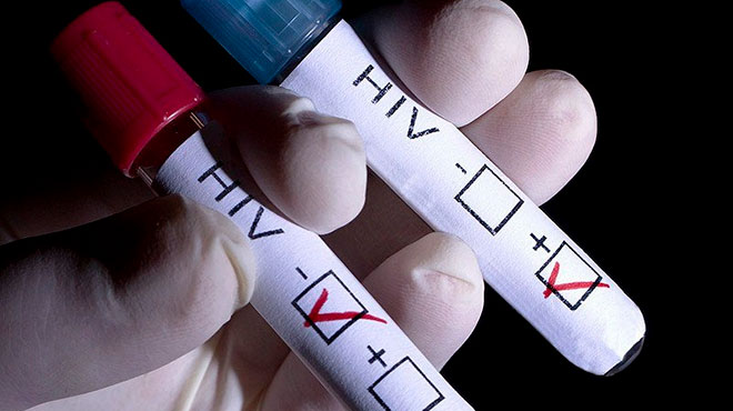 Logran hacer el VIH indetectable tras un trasplante de células madre