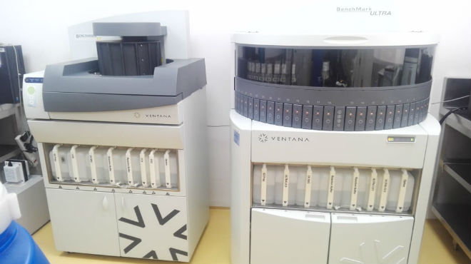 Hospital Eugenio Espejo retoma la inmunohistoquímica con una nueva ...